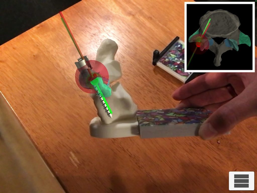 The Role of Augmented Reality in the Next Phase of Surgical… : Plastic ...